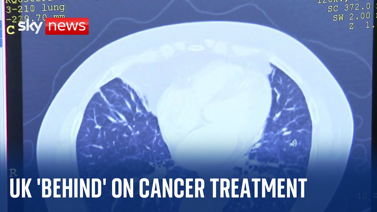 UK cancer patients suffering as nation behind in treatments, research ...
