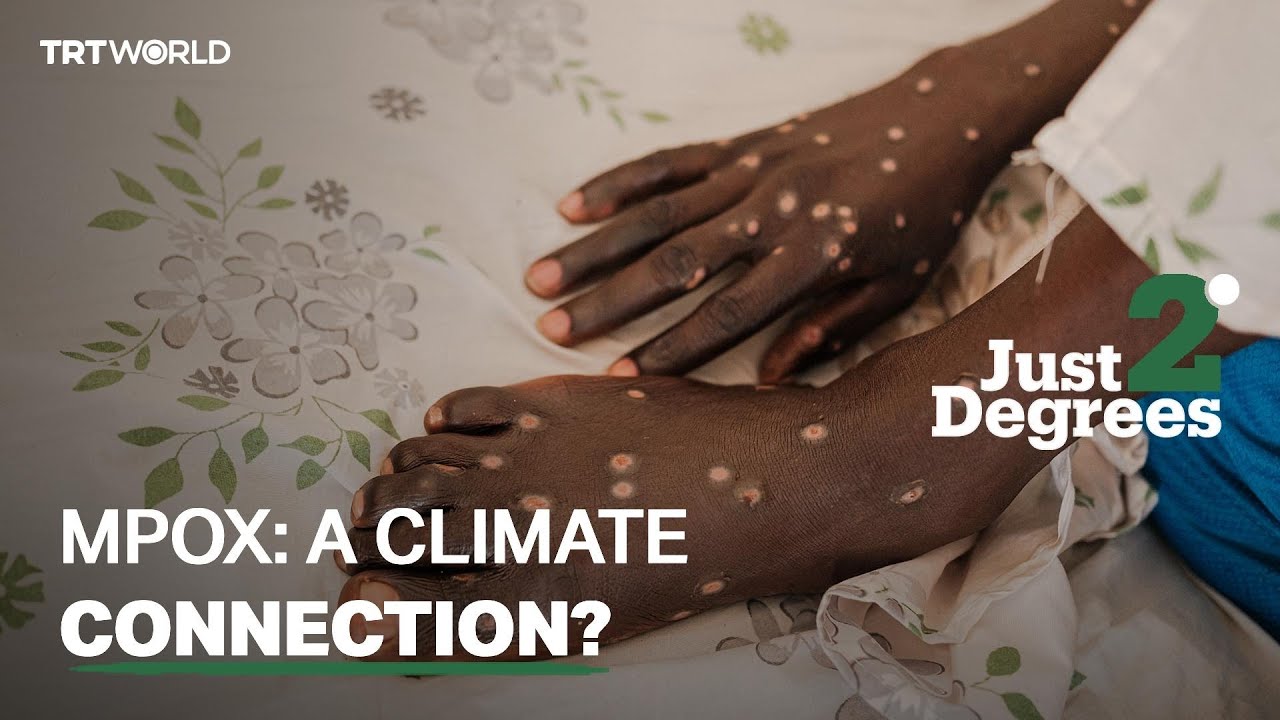Just 2 Degrees: Mpox infections spread, climate connection? - World News