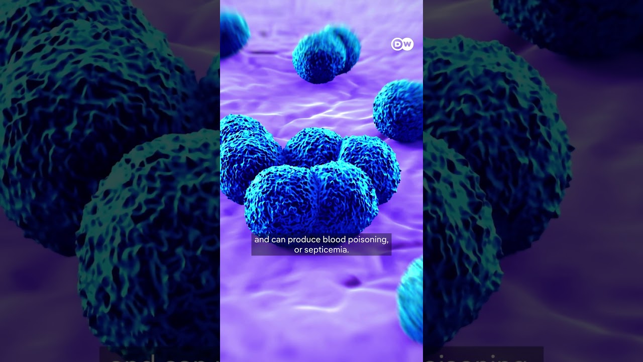 The UK's 'unprecedented' meningitis outbreak: what we know | DW News ...